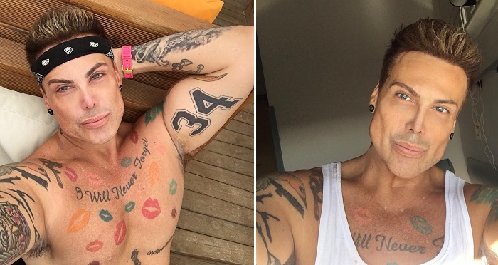 Plastic Surgery Addict Left With Longer, Painful Erection After Failed ...