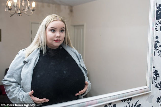 Meet 25-year-old lady with gigantic breasts that won't stop growing due ...