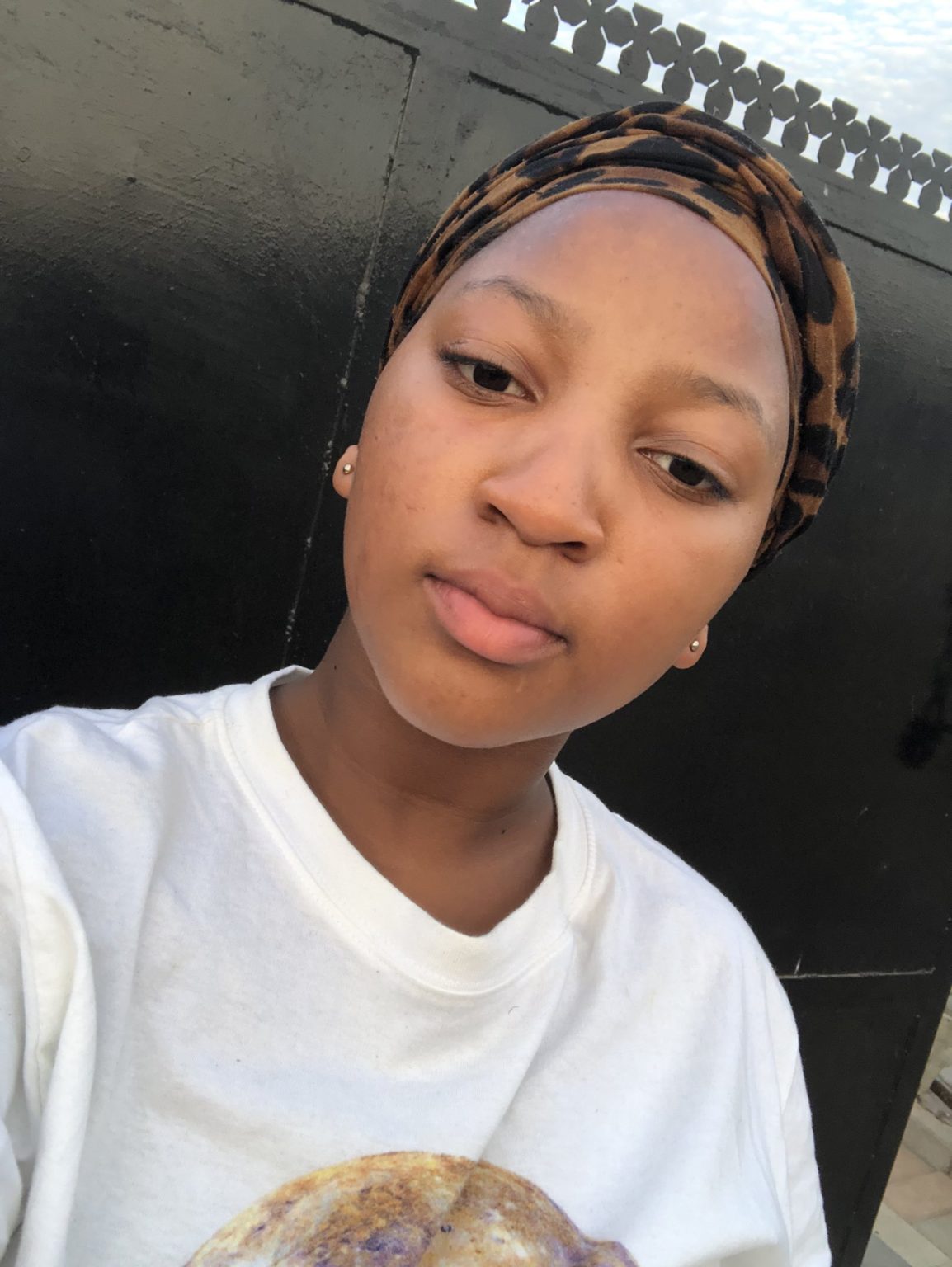 Lady diagnosed with acne shocks many after sharing photos of her facial ...
