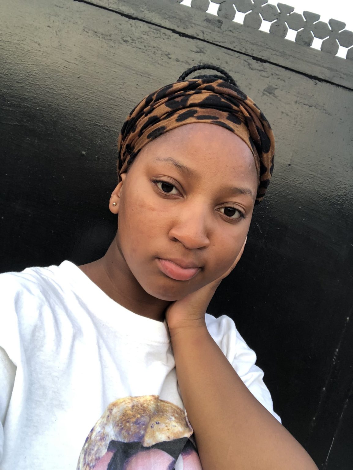 Lady diagnosed with acne shocks many after sharing photos of her facial ...