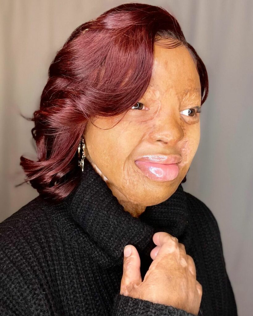 Singer, Kechi Okwuchi grateful for being able to wear earrings again ...