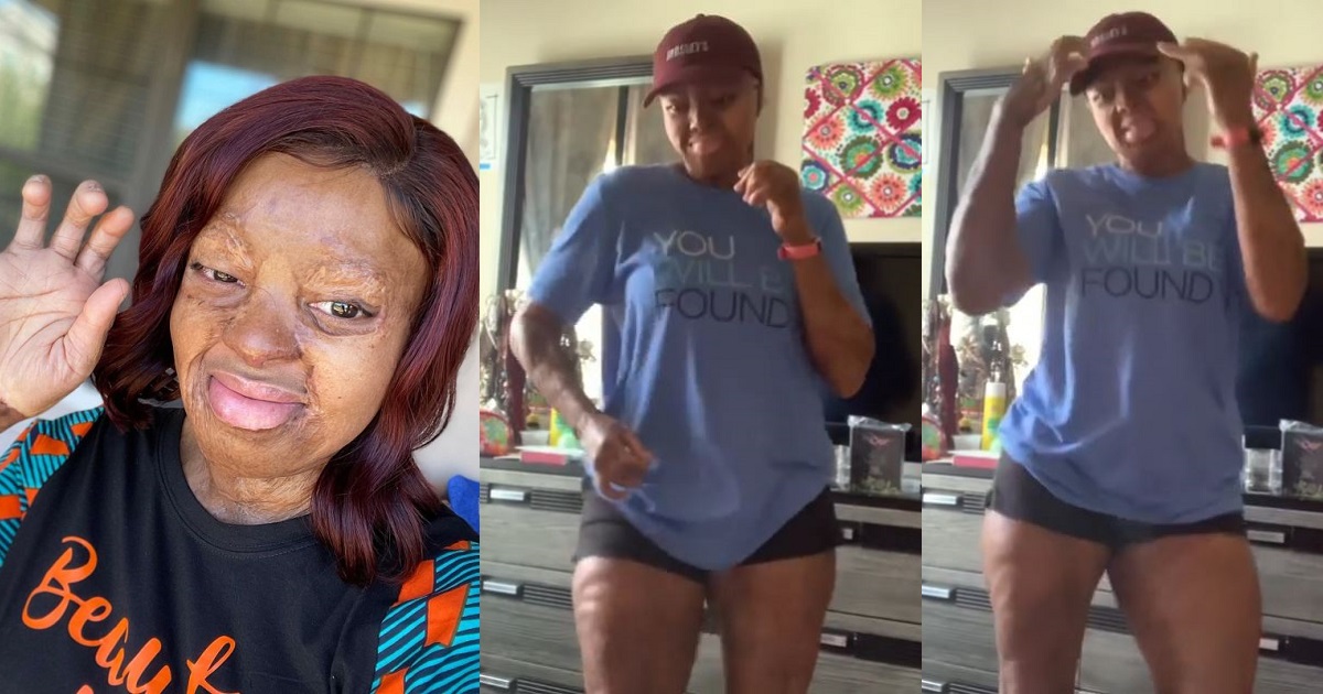 Crash survivor and singer, Kechi, shows off her amazing dance moves ...