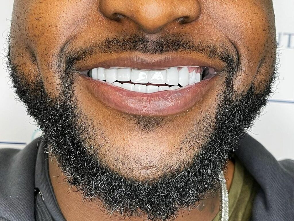 Singer, Davido flaunts his billionaire smile after whitening his teeth ...