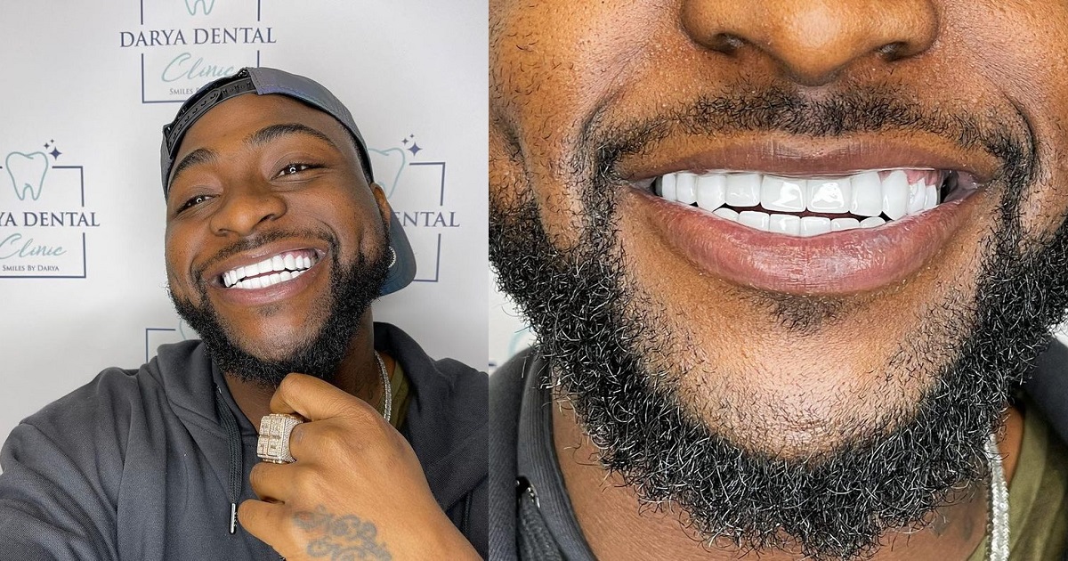 Singer, Davido flaunts his billionaire smile after whitening his teeth ...