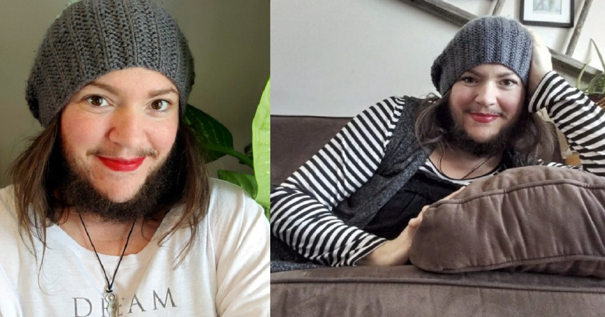 "I was so ashamed of my beard" – Woman says she has finally accepted ...