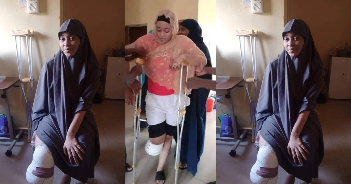 16-year-old girl's leg amputated on graduation day after being crushed ...