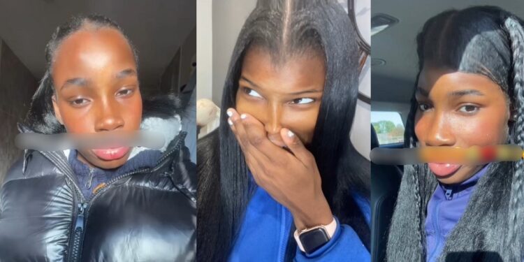 Lady shows off her before and after forehead surgery transformation ...